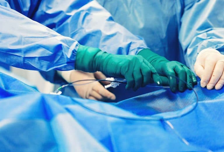 What Are The Advantages Of Minimally Invasive Vascular Surgery? – Dr Kalko